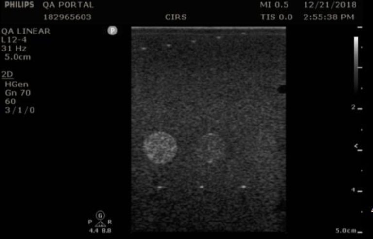 Multi-Purpose, Multi-Tissue Ultrasound Phantom - CIRS Product Support