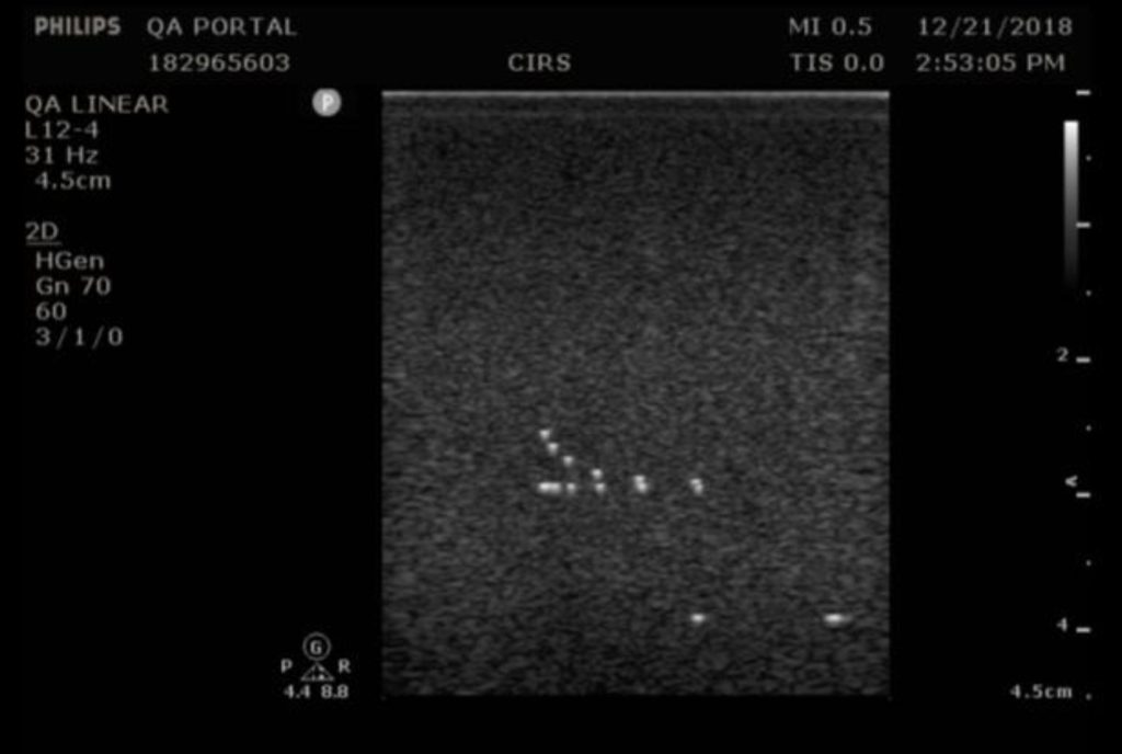 General Purpose Ultrasound Phantom - CIRS Product Support