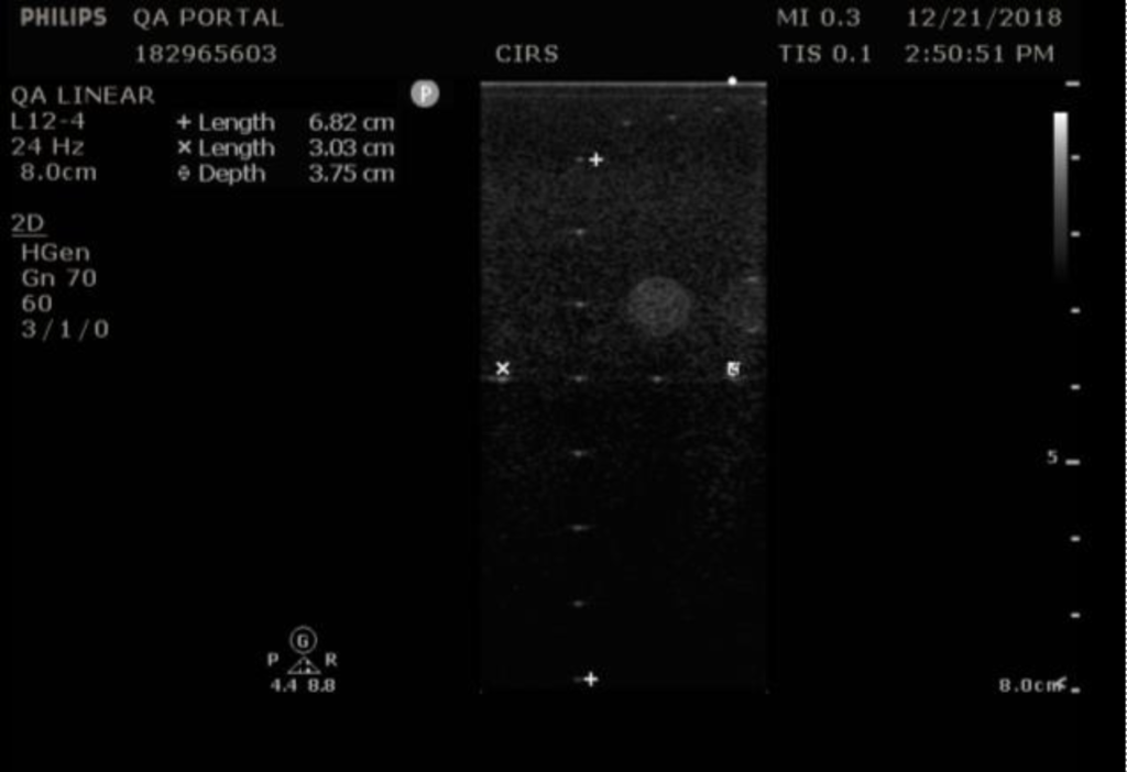 Multi-Purpose, Multi-Tissue Ultrasound Phantom - CIRS Product Support