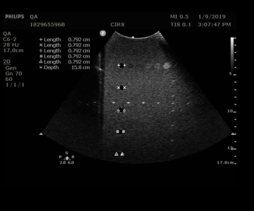 General Purpose Ultrasound Phantom - CIRS Product Support