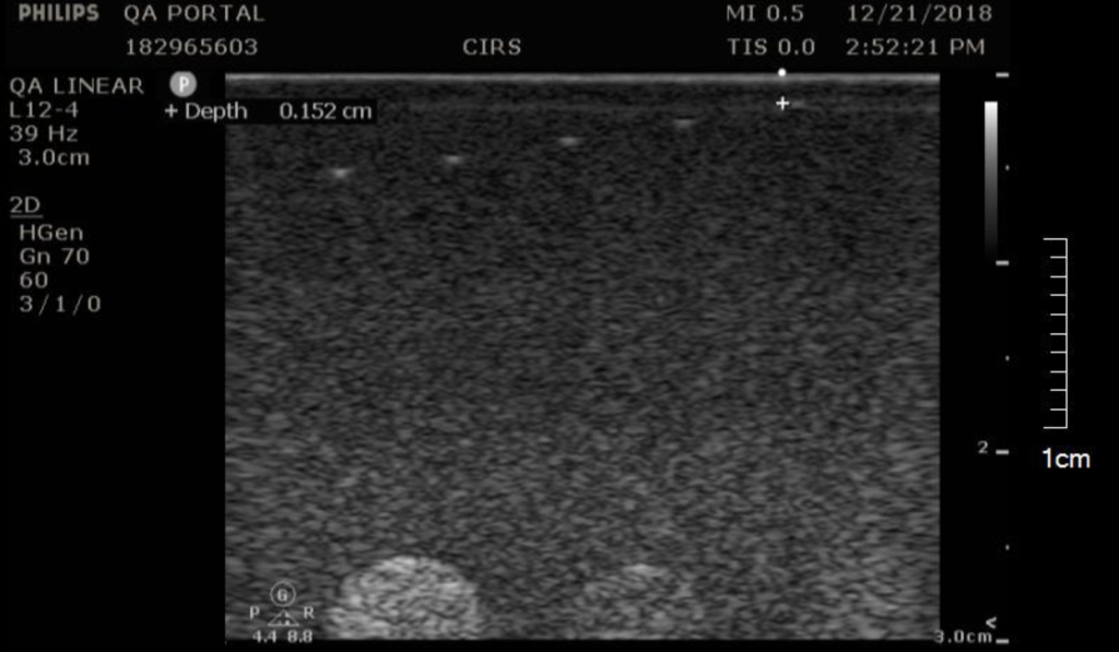 Multi-Purpose, Multi-Tissue Ultrasound Phantom - CIRS Product Support